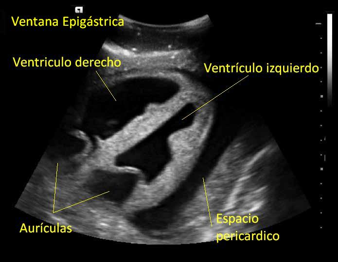 Eco FAST: Aprende la técnica para realizarlo en urgencias.